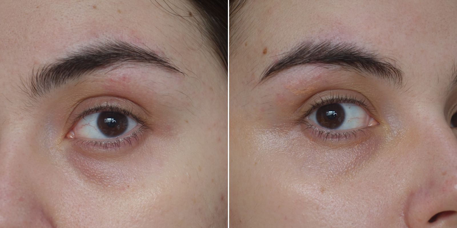 Review: +C Vit UnderEye Brightener – Pixi Beauty | Is it worth it ...